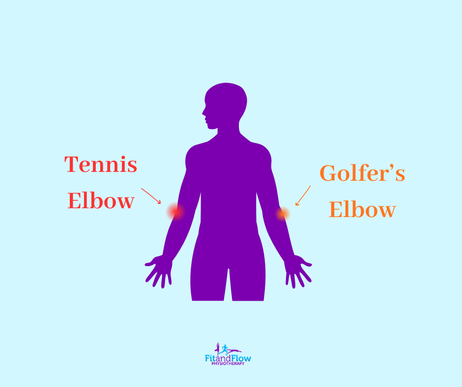 Tennis Elbow vs Golfer’s Elbow: What’s the Difference? - Fit and Flow ...